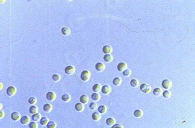 pict and desc. of Stichococcus chlorelloides