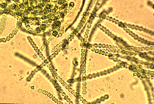 Pict and descrip - Nostoc linkia